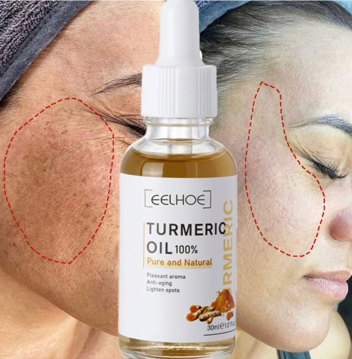 AntiAging ™ - Turmeric Dark Spot Corrector Serum – TechanovaFinds